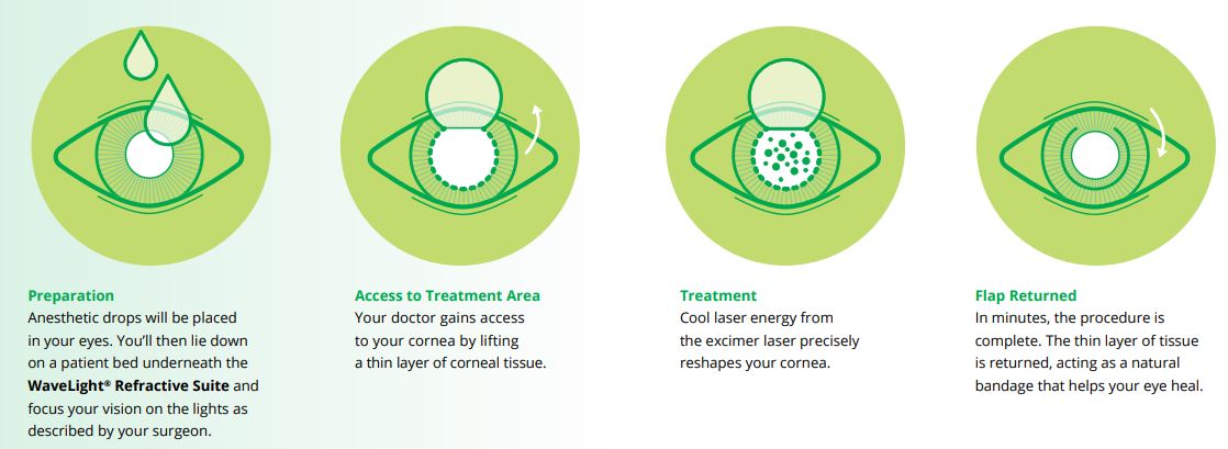 LASIK Baton Rouge | What to Expect | Williamson Eye